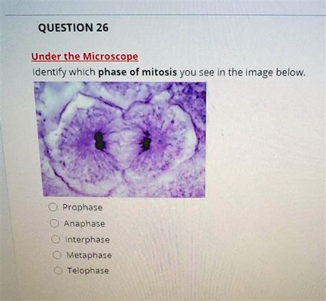 Interphase Under Microscope