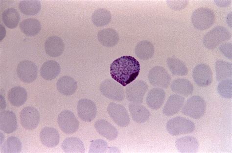 Free Picture Micrograph Plasmodium Vivax Macrogametocyte Distinct Schufners Dots Mag 1125x