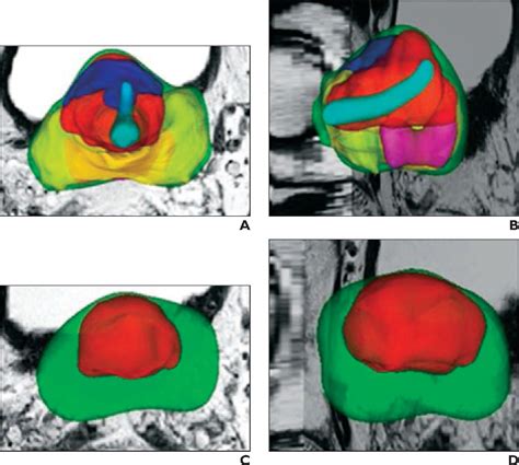 Figure 1 From Data Augmentation And Transfer Learning To Improve Generalizability Of An