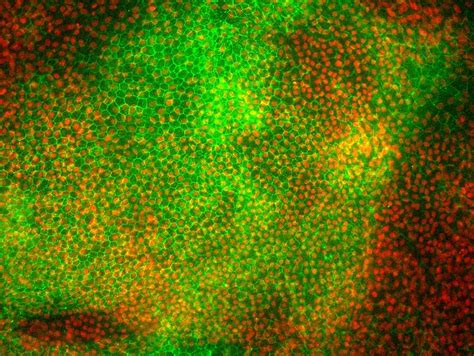 Stem Cell Derived Retinal Cells By Science Photo Library