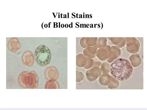 Vital Staining Ppt Notes Pptx