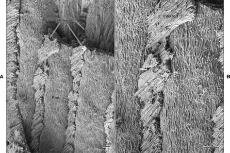 7 Enamel Composition Formation And Structure Pocket Dentistry