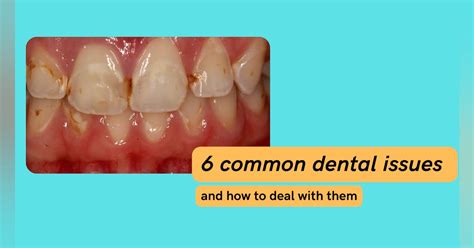 6 Common Dental Problems—and How To Fix Them Dentistry Iq