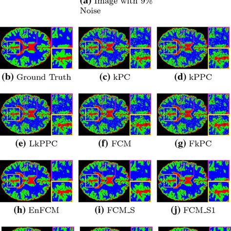 Qualitative Segmentation Performance Of Proposed Method And Related Download Scientific Diagram