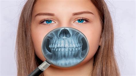 درمان با جراحی فک و صورت دکتر فاطمه تیموری