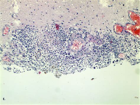 Staining With Haematoxylin And Eosin Enlargement 200x E Polymorphic Download Scientific