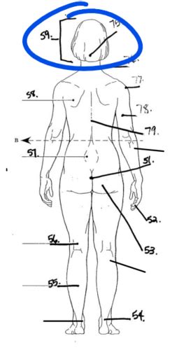Hap Posterior Flashcards Quizlet