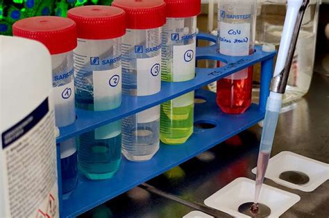 How Long Coronaviruses Persist On Surfaces And How To Inactivate Them