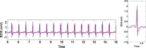 Comparison Between Numerical Dashed Black Line And Experimental Pink