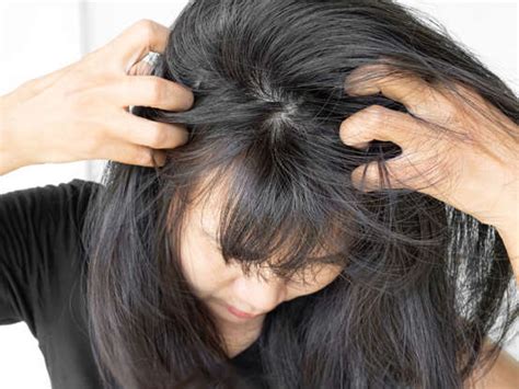 Why Is My Scalp So Itchy