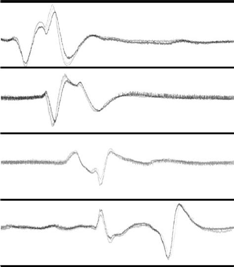 Three Sets Of 22 Min Recordings Of Integrated Ecog Signal From Three