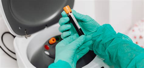 Volumetric Absorptive Microsampling Lc Ms Ms Assays For Quantitation Of Giredestrant In Dried