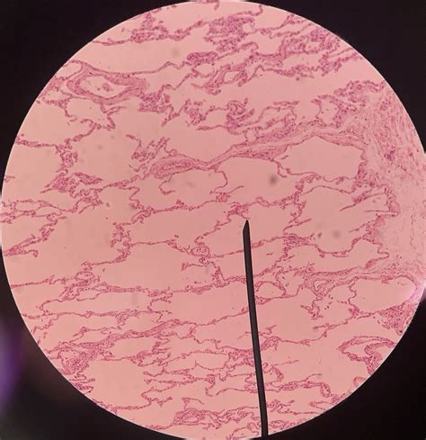 Lung Microscope Diagram Quizlet