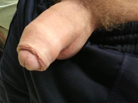 Partial Erection Coverage Album On Imgur