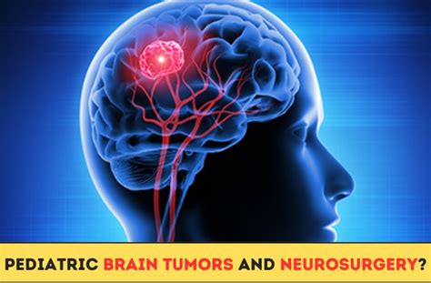Pediatric Brain Tumors And Neurosurgery Dr Ninad Patil