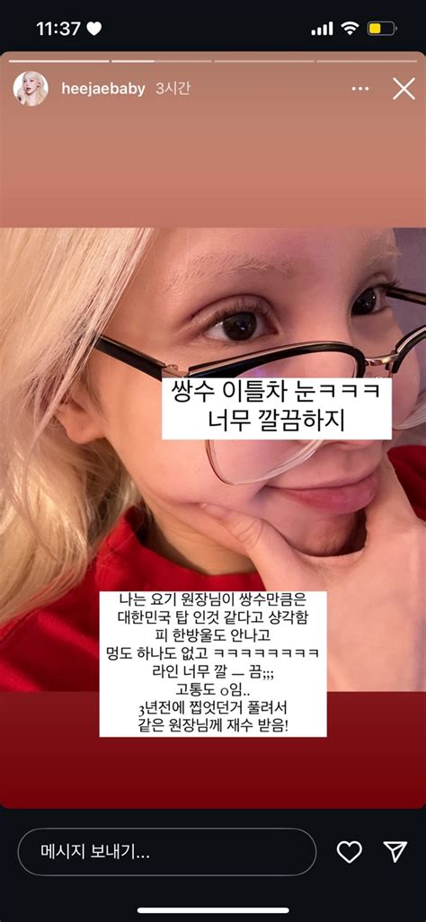 시술 수술 질문 유튜버 희재님 눈수 강남언니 1등 성형수술and피부시술 정보앱