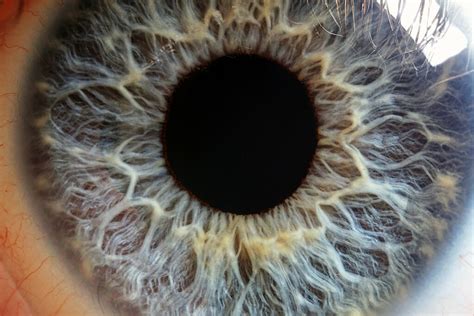 Eye Iris Under Microscope At Harrison Greenwood Blog