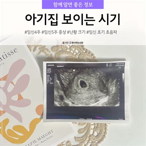 아기집 보이는 시기 임신 4주 5주 증상 난황 크기 초음파 네이버 블로그