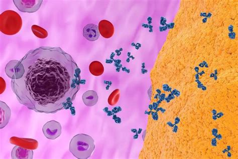 Rheumatoid Factor Rf Antibodi Yang Ditemukan Pada Penderita Rheumatoid Arthritis