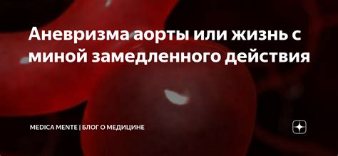 Аневризма аорты или жизнь с миной замедленного действия Medica Mente Блог о медицине Дзен