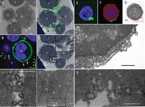 Large Puncta Transferred To Target Cells Correlate With Electron Dense