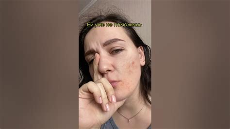 Бедолага 🫠Главное найти своё средствое. Сыворотка с ниацинамидом от ...