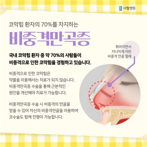 수원 기능코성형 코의 기능성심미성 모두 고려한 더웰병원 기능코성형 건강정보 수원 더웰병원