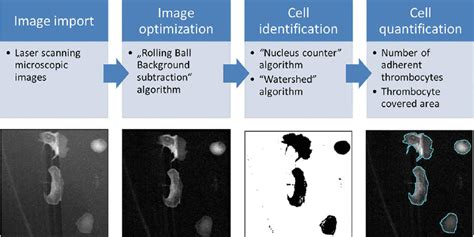 Workflow Sequence Of The Automated Image Processing In Imagej