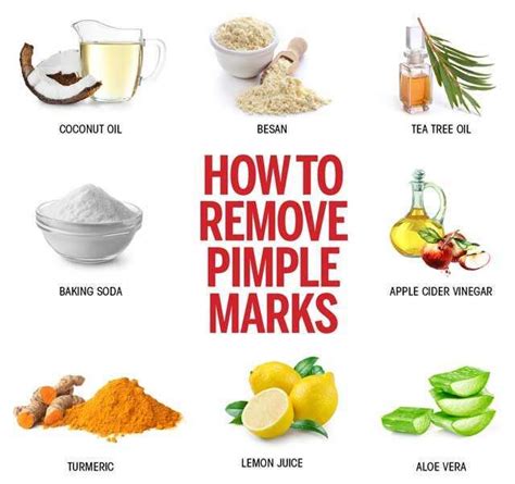 How To Remove Pimple Marks Effective Ways Femina In How To Remove Pimples Pimple Marks How