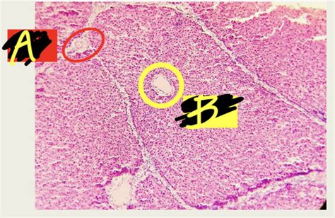 Flashcards Accesory Organs Quizlet