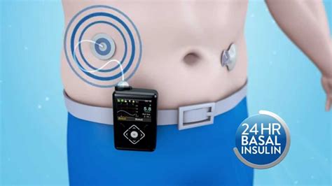 Medtronic Insulin Pump