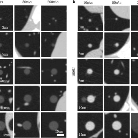 Example Of Ct Images Reconstructed With Fbp Std Methods At Slice