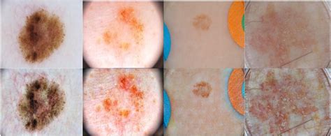 Example Of Lesion Data Augmentationthe First Row Are Some Original Download Scientific Diagram