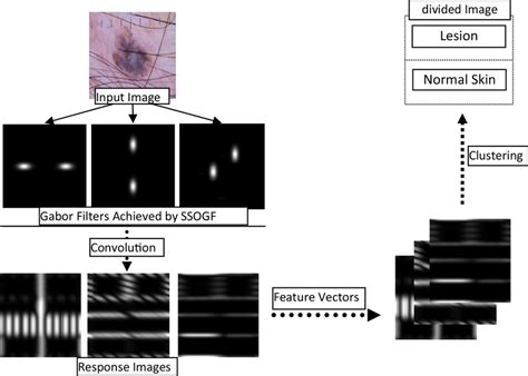 Flowchart Describing The Work Flows Of The Proposed Gabor Based Lesion Download Scientific
