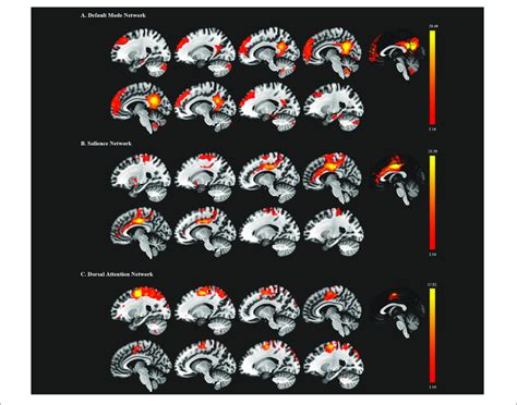 Functional Brain Networks Chosen From The Independent Component Download Scientific Diagram
