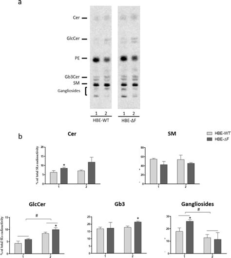 Sphingolipid Pattern Of Human Primary Bronchial Cells Derived From Download Scientific Diagram