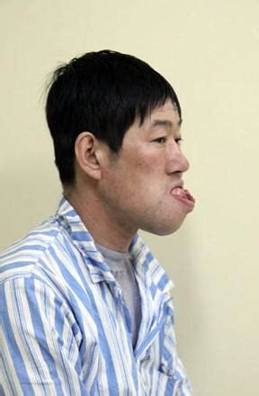 下颌骨肿瘤 搜狗百科