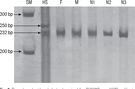 [pdf] Haddad Syndrome With Phox2b Gene Mutation In A Korean Infant