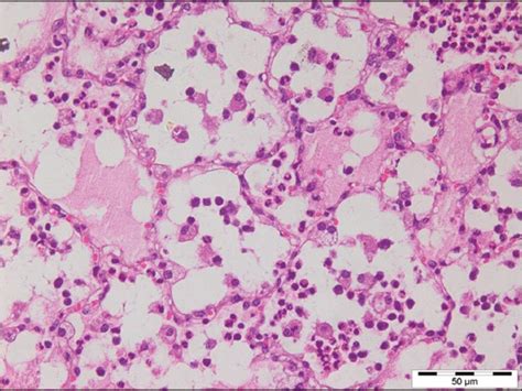 Histopathological And Immunohistochemical Approaches For The Diagnosis