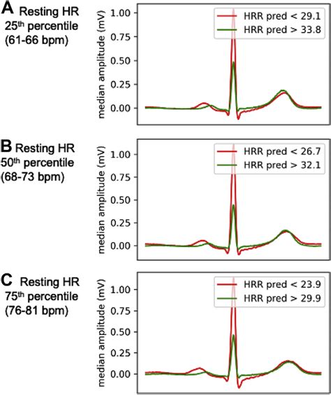 Representations Of Deep Learning Electrocardiogram Ecg Model