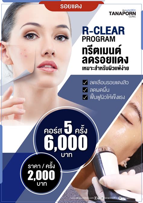 R Clear Program ทรีตเมนต์ลดรอยแดง