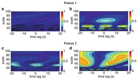 Low Correlation Is Shown At Baseline Ecmo Flows A And C And High