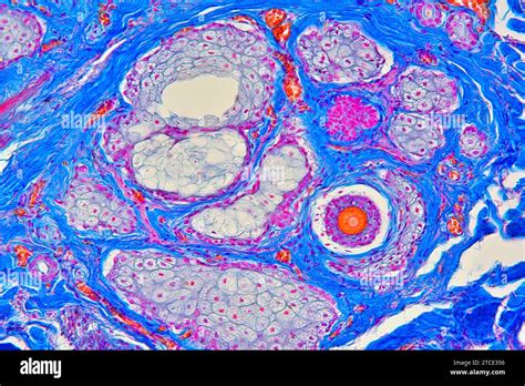 Human Scalp Cross Section Showing Hair Follicles Sebaceous Glands And Fibrous Tissue Optical