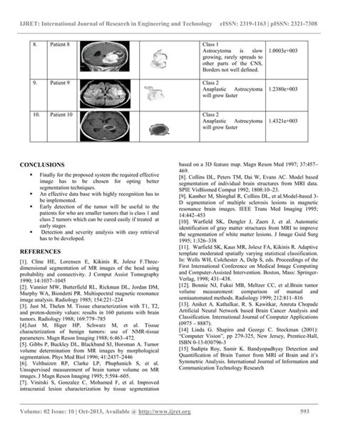 Automatic Detection And Severity Analysis Of Brain Tumors Using Gui In
