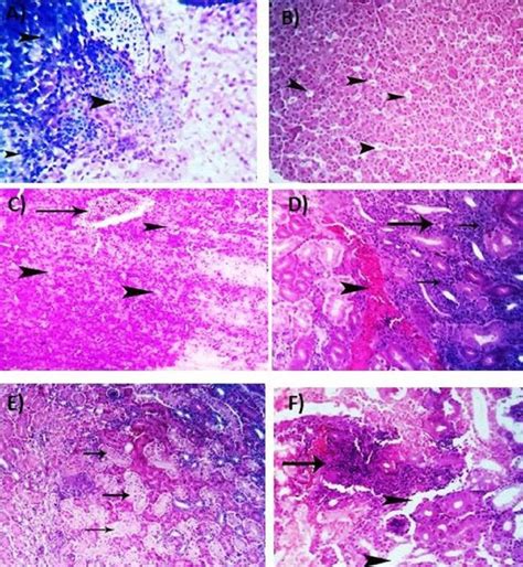 A Photomicrograph Of The Liver In Gp3 At First Day Post Treatment