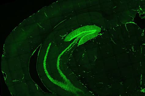 Mapping The Role Of Interleukin 1 In Brain Function And Disease