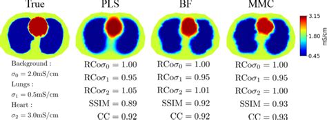 Case 2 Reconstructions And The Corresponding Quantitative Evaluation