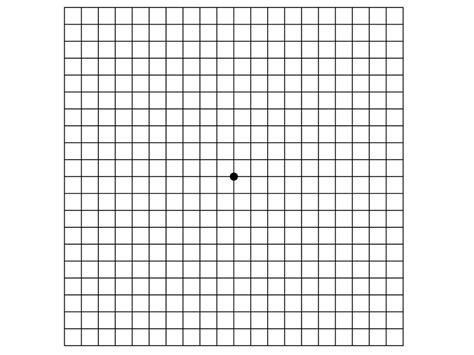 Manual Visual Field Test