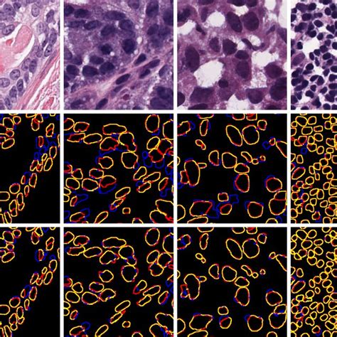 Pdf A Dataset And A Technique For Generalized Nuclear Segmentation For Computational Pathology