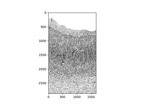 Anatomically Guided Reproducible Extraction Of Full Resolution Image Data From Cloud Resources